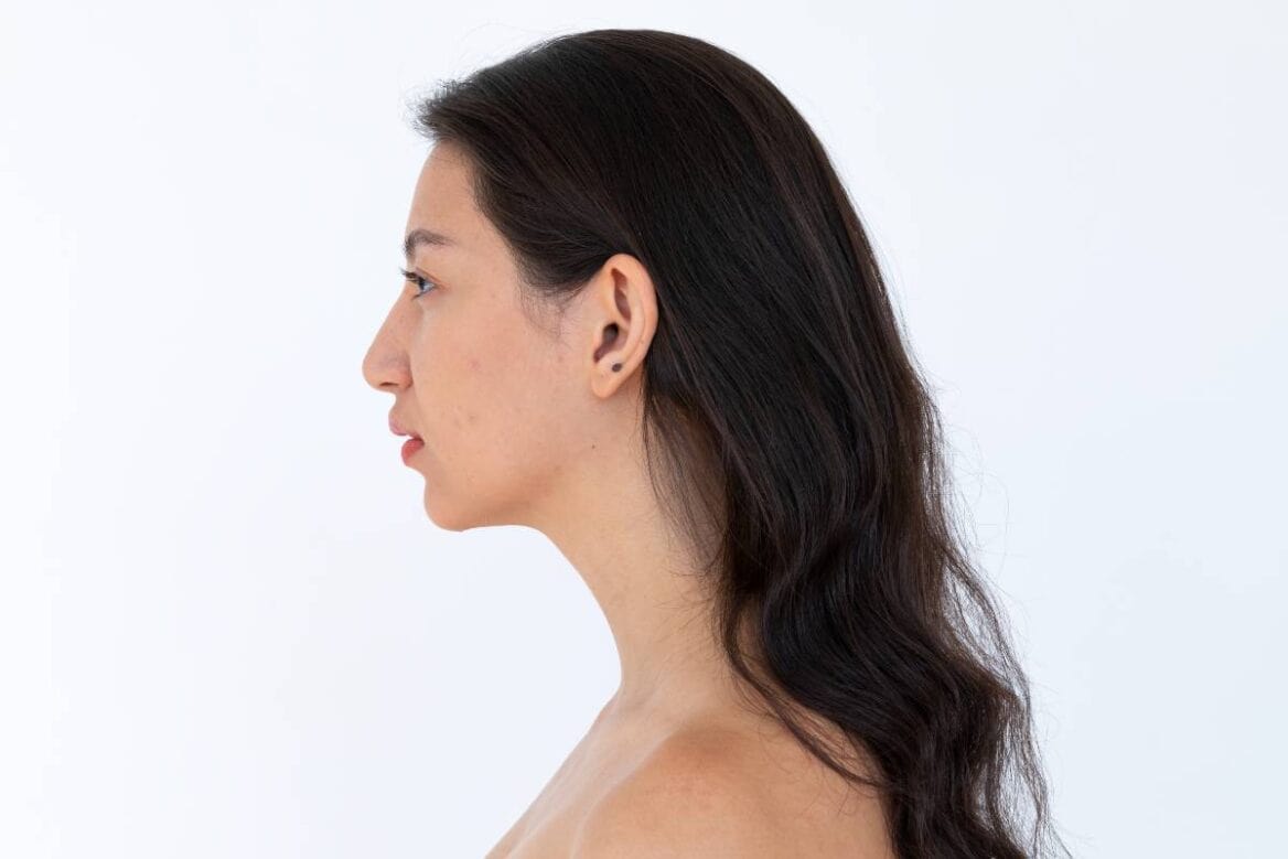 What Is a Reversed Cervical Curve? Find Out Here - The BodyFix - Mt ...